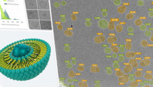 LNP meets high-throughput Cryo-EM: Reliably quantifying LNP morphology ...
